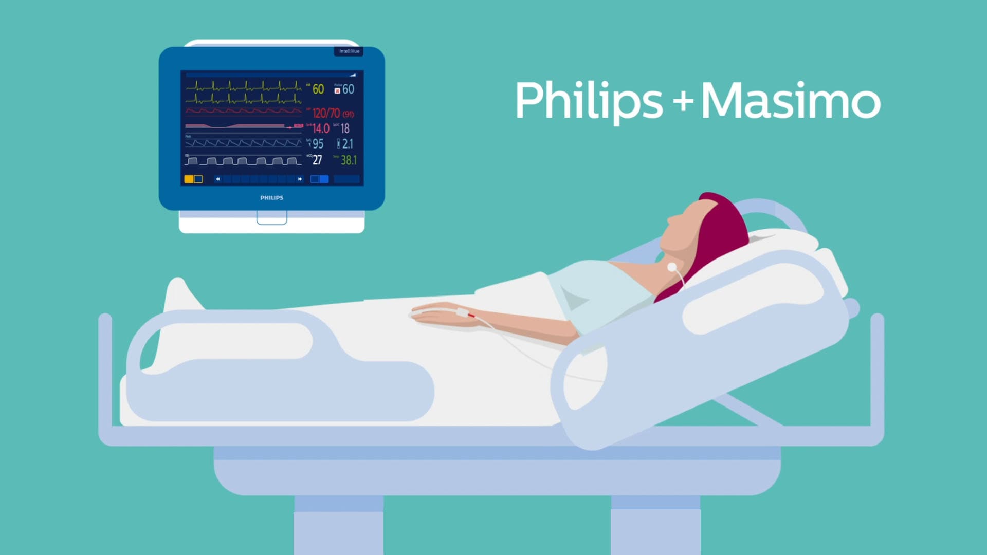 Partenariat entre Philips et Masimo | Philips Healthcare